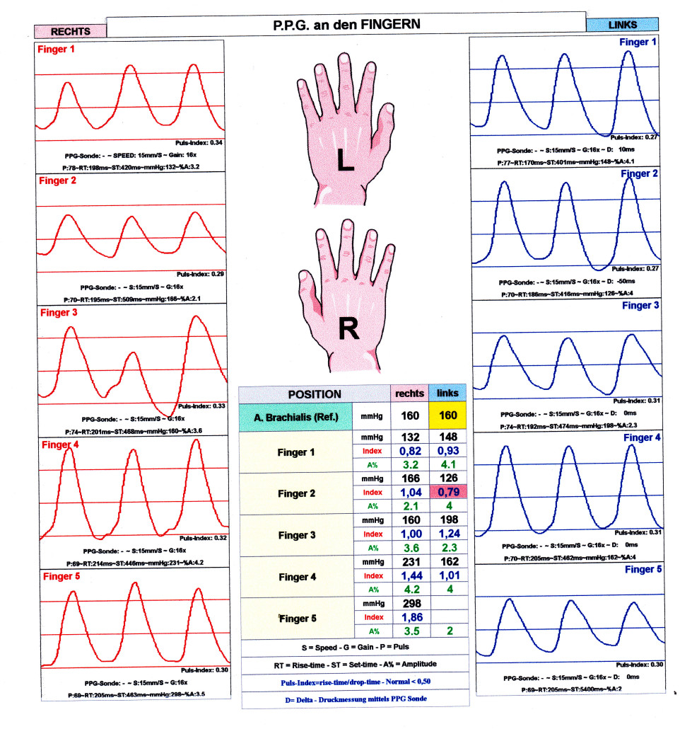 Praxis-Kauschke.de | Puls – Photo – Plethysmographie